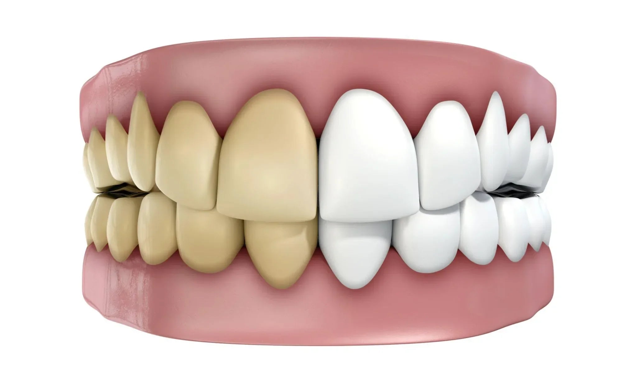 How to Clean Badly Stained Dentures – Ola Fresh - Professional Strength ...